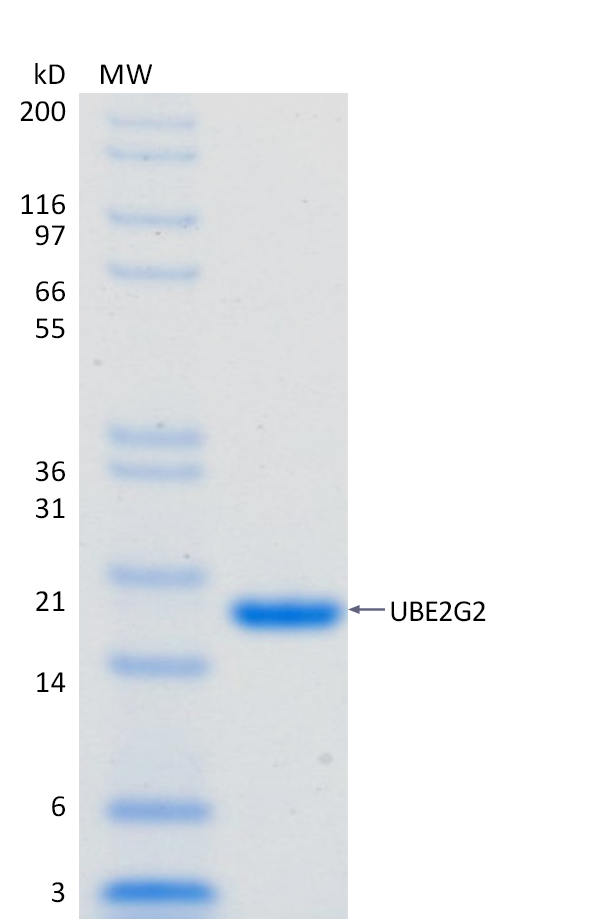 Active, Recombinant Human UBE2G2 – Trilogie Bioscience